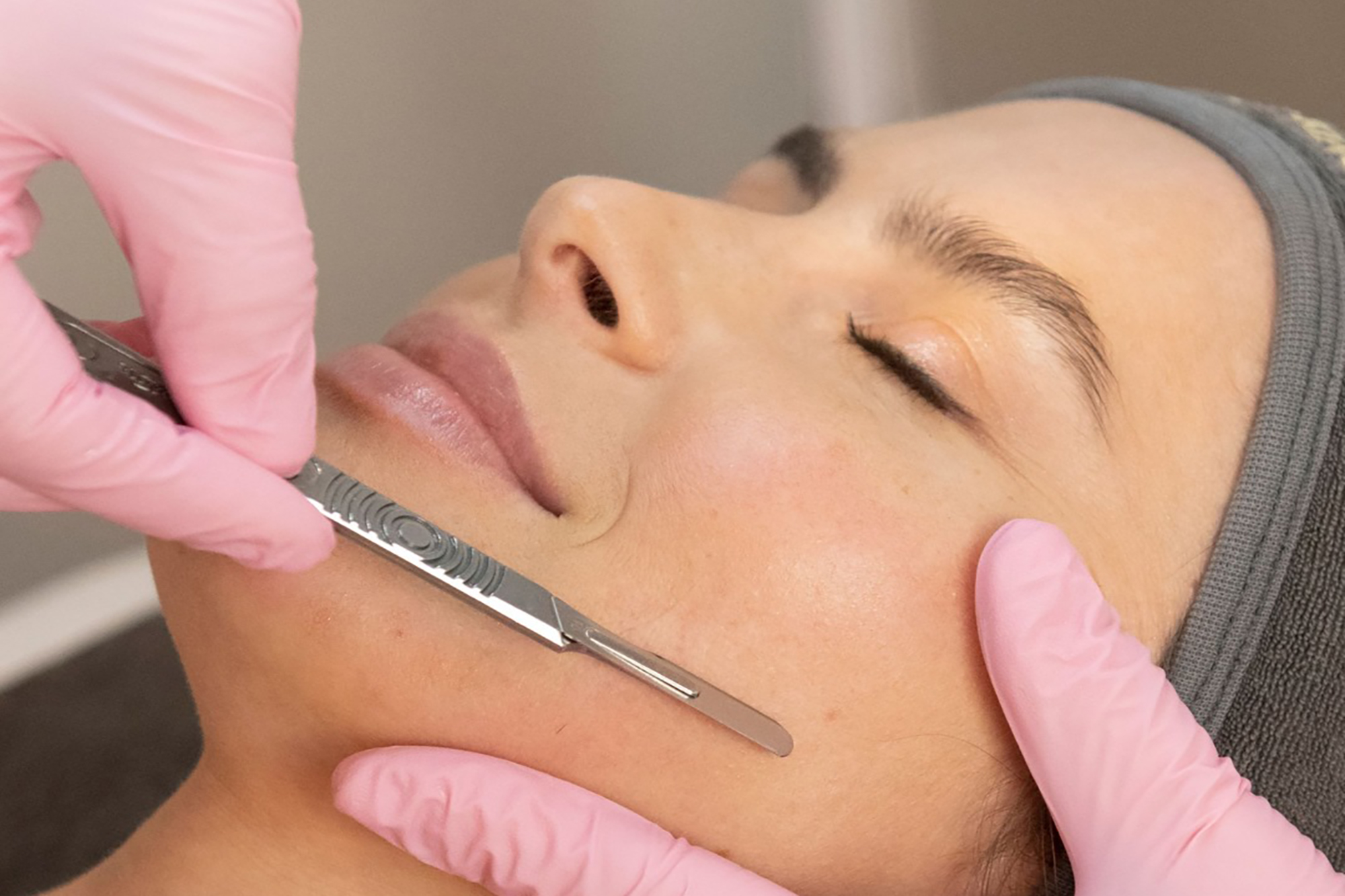 Facial Skin Care & Skin Rejuvenation at InSkin Solutions